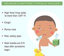 MEASLES: IMPORTANT INFORMATION - Genesis Pediatrics